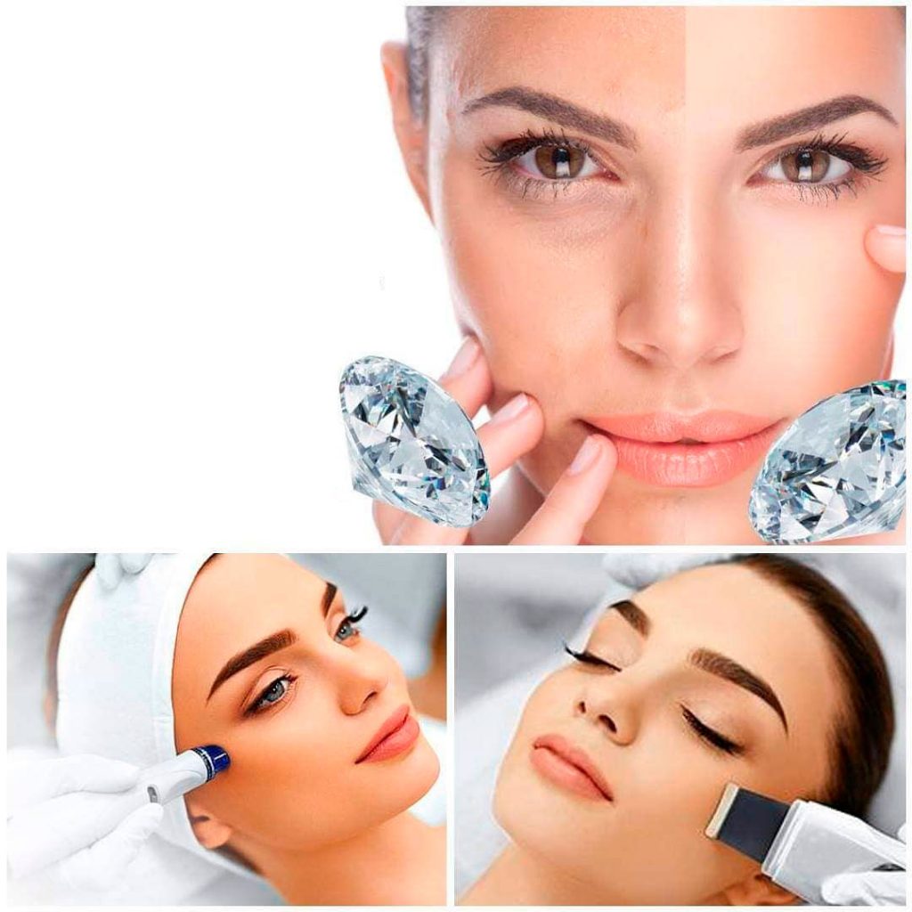 Limpieza facial con punta de Diamante. ¡Tendrás tu rostro como nunca!